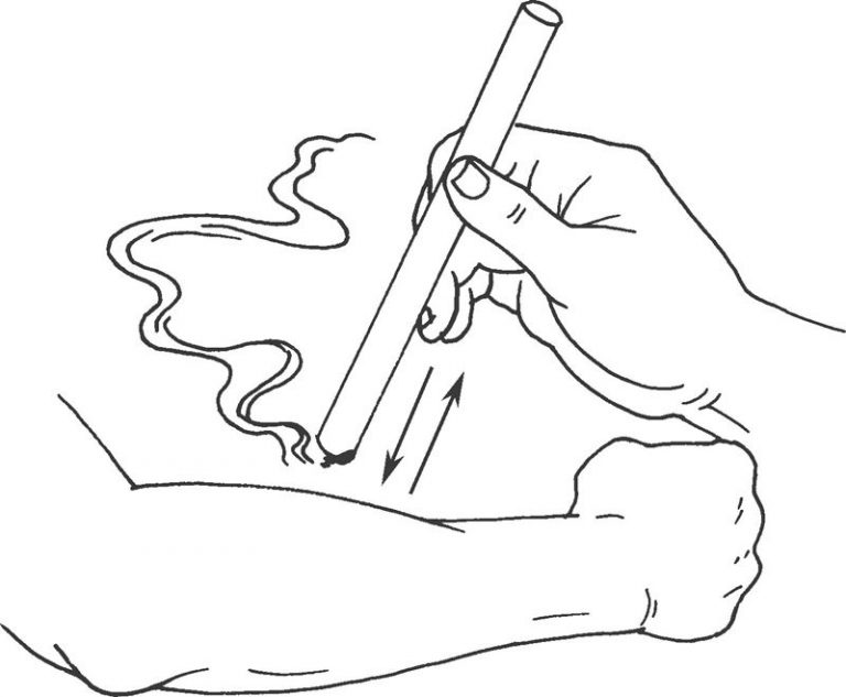 Types of Moxa Stick Moxibustion - Moxabio