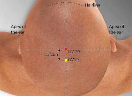 Top 15 Acupuncture Points for Weight Loss - Moxabio