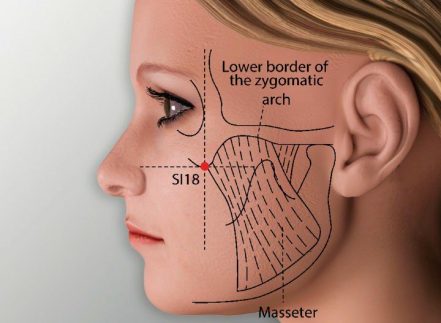 Top 10 Acupuncture Points For Toothache - Moxabio